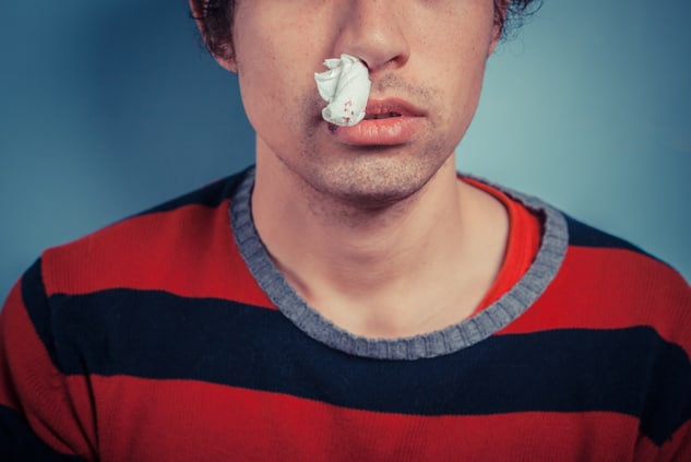6 Things You Should Do When You Have A Nosebleed | Sacramento Ear, Nose ...